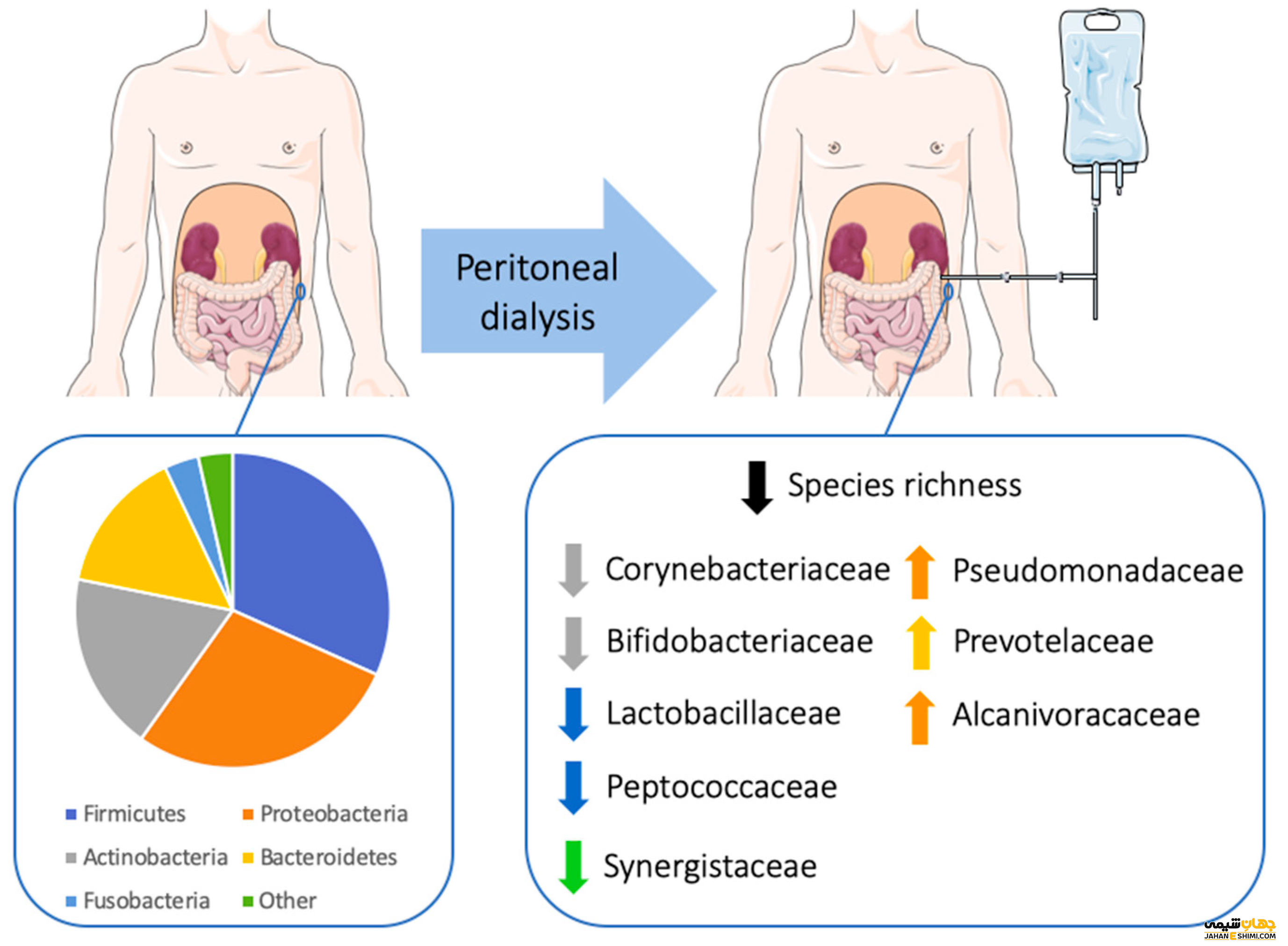 صفاق چیست و از عملکرد و بیماری های آن چه می دانید؟ | جهان شیمی فیزیک